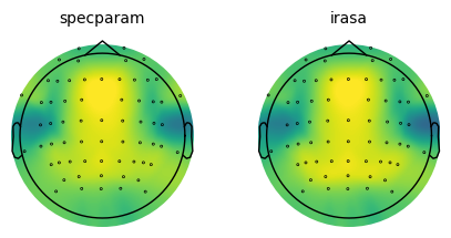 Resting EEG Data — Aperiodic Methods