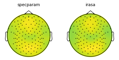 Developmental EEG Data — Aperiodic Methods