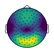 Developmental EEG Data — Aperiodic Methods